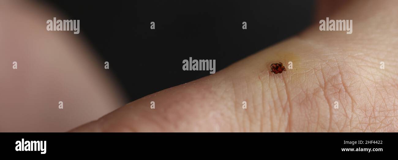 Detailed picture of insect Stock Photo - Alamy