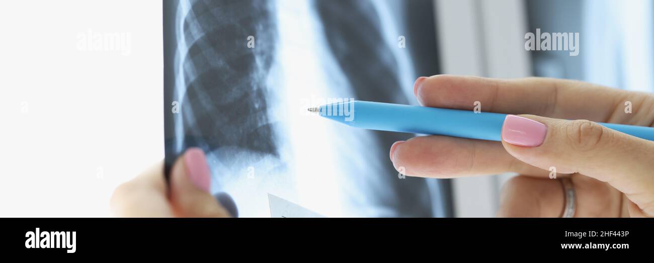 Scan of pulmonary Stock Photo - Alamy