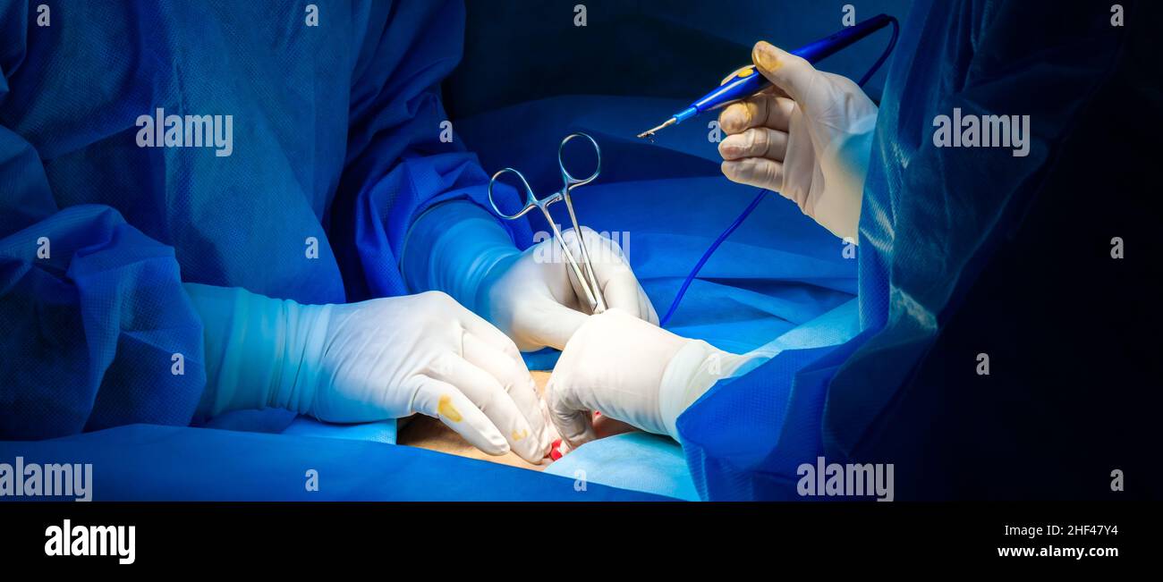 A team of surgeons in blue surgical uniforms and white sterile gloves ...