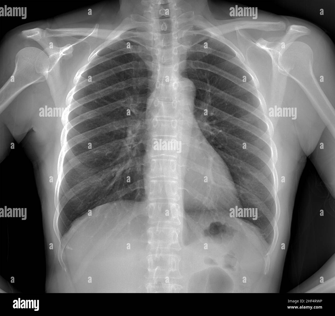 Patient care post use Black and White Stock Photos & Images - Alamy