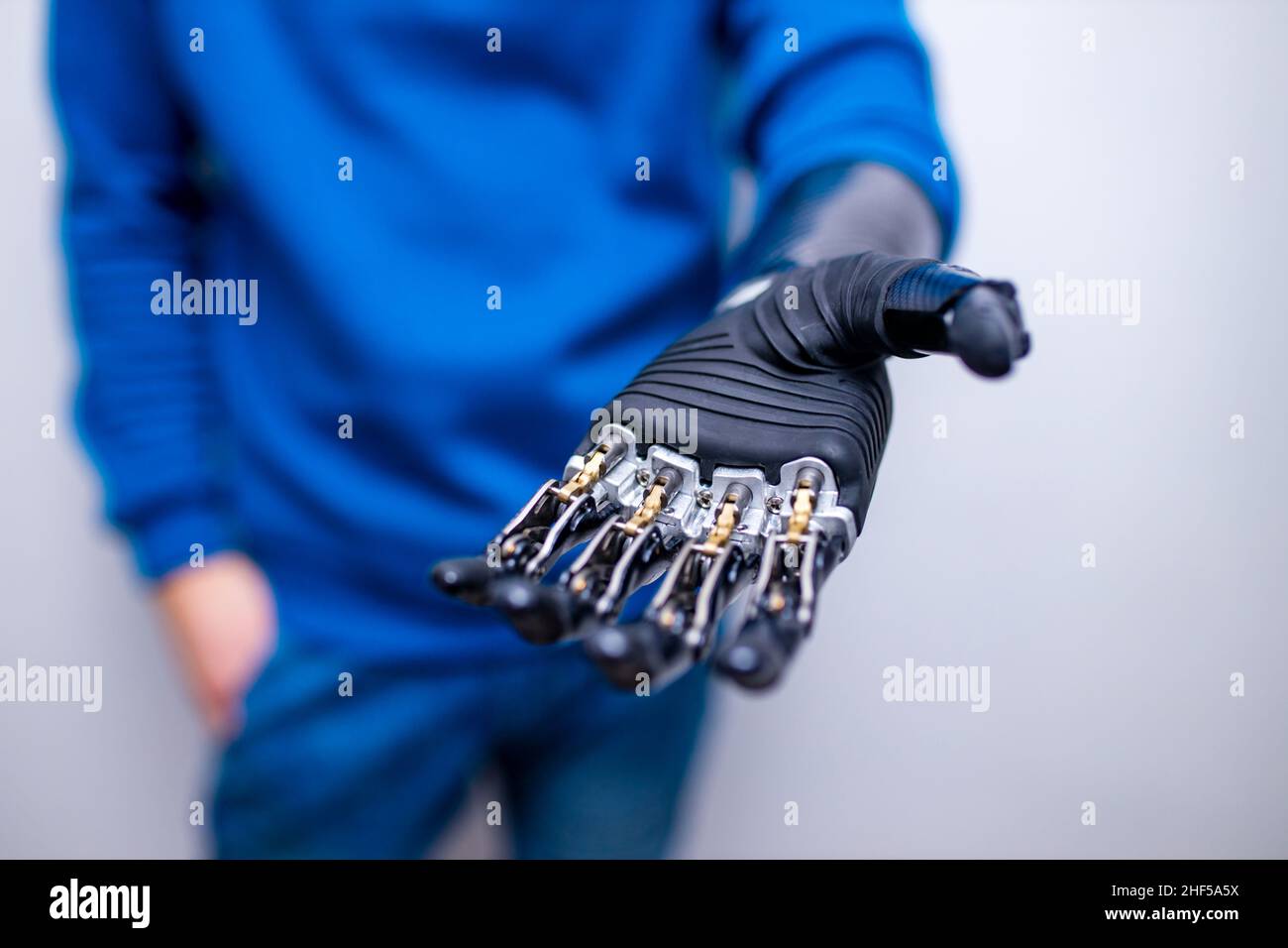Hand amputee hi-res stock photography and images - Alamy