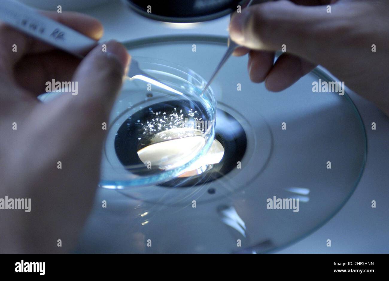 Chorion hi-res stock photography and images - Alamy