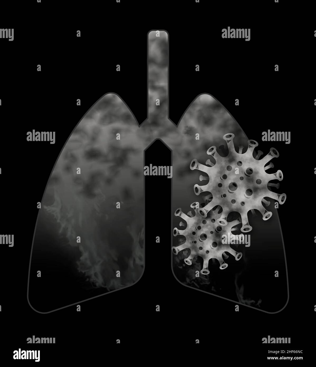 X ray of lungs hi-res stock photography and images - Alamy