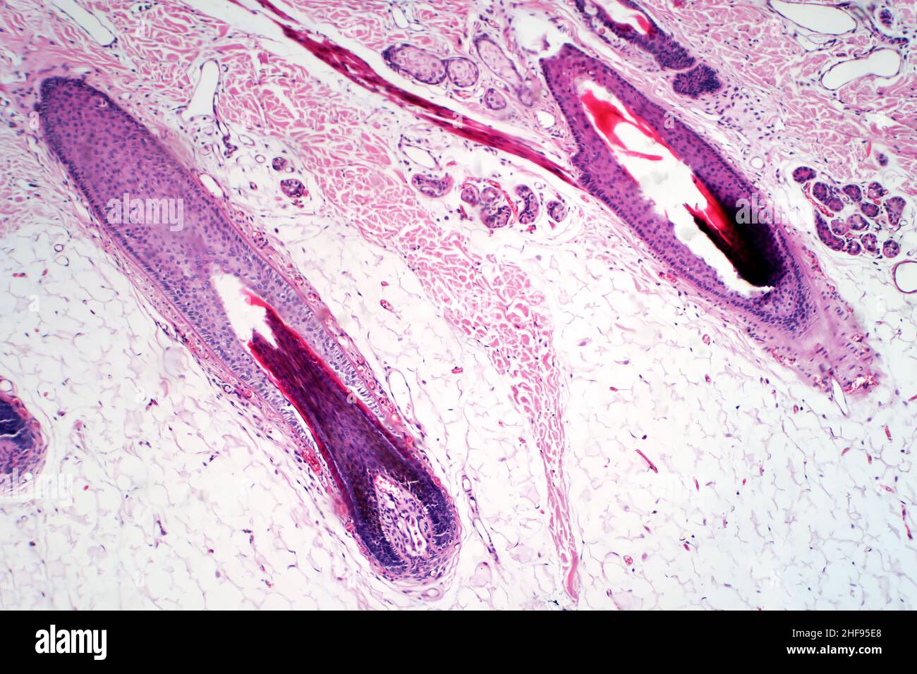 Human scalp and hair follicle, light micrograph Stock Photo - Alamy