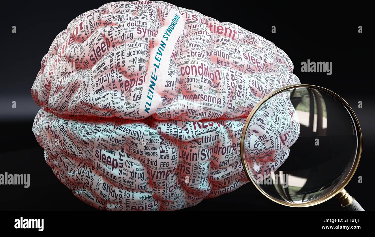 Kleine levin syndrome in human brain hi-res stock photography and ...