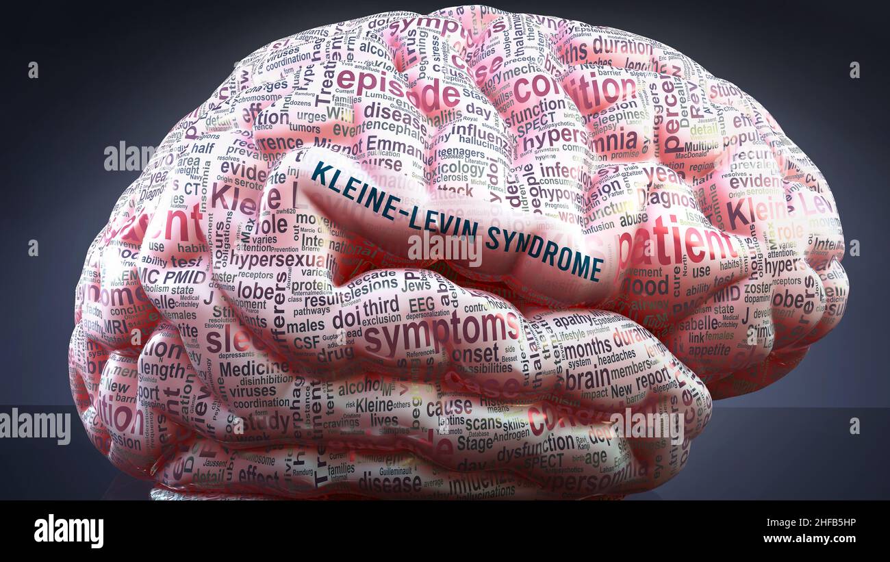 Kleine levin syndrome in human brain hi-res stock photography and ...