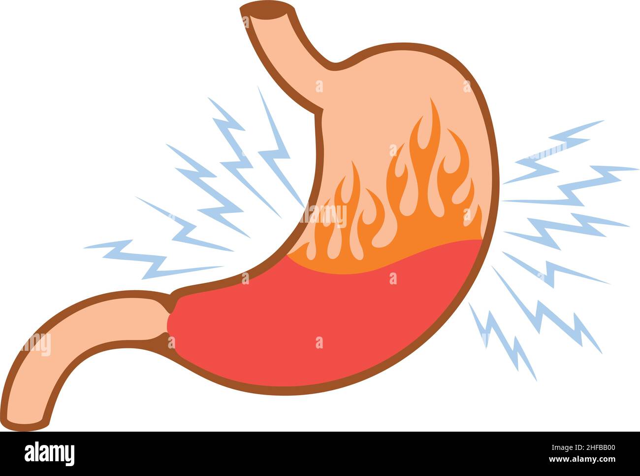 Human internal stomach heartburn problems concept. Vector illustration ...