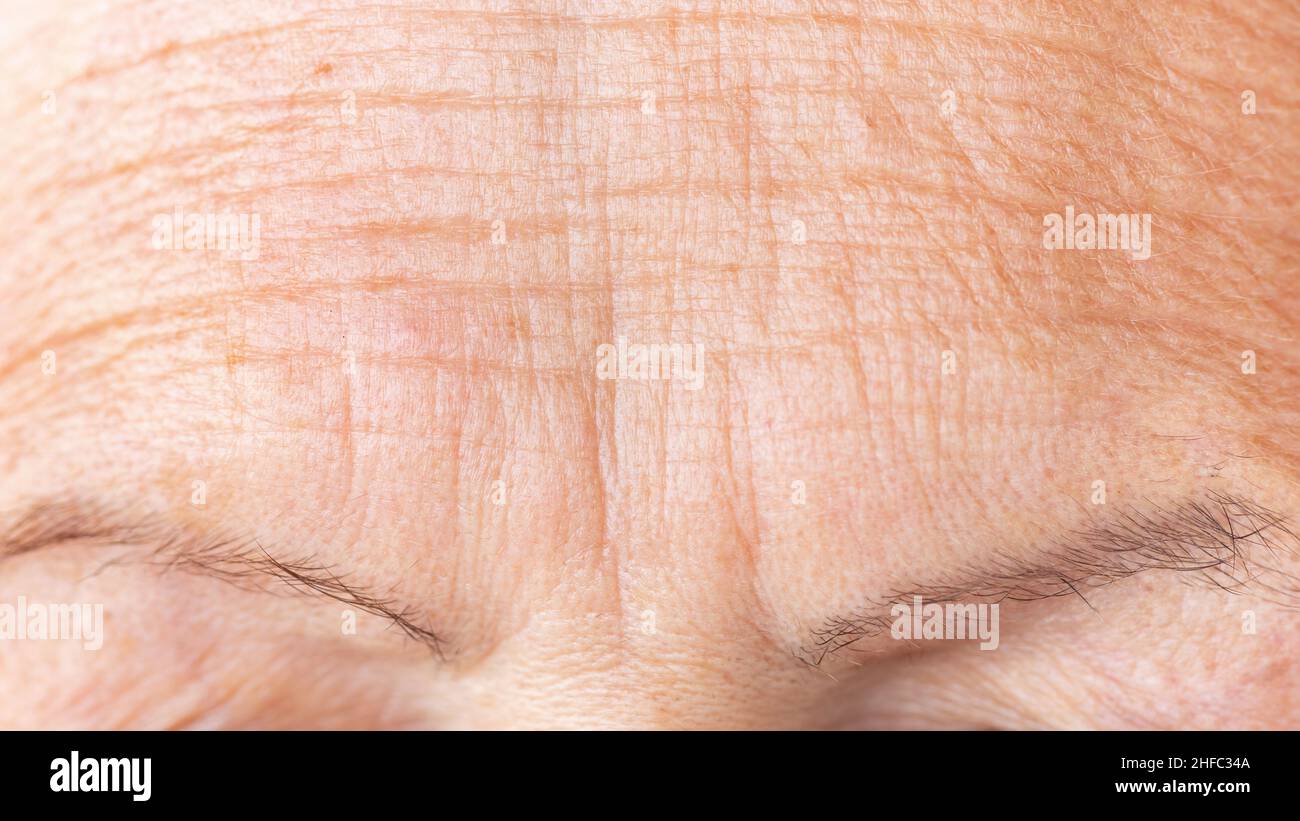 Wrinkled skin of a mature woman's forehead macro photography. Deep ...