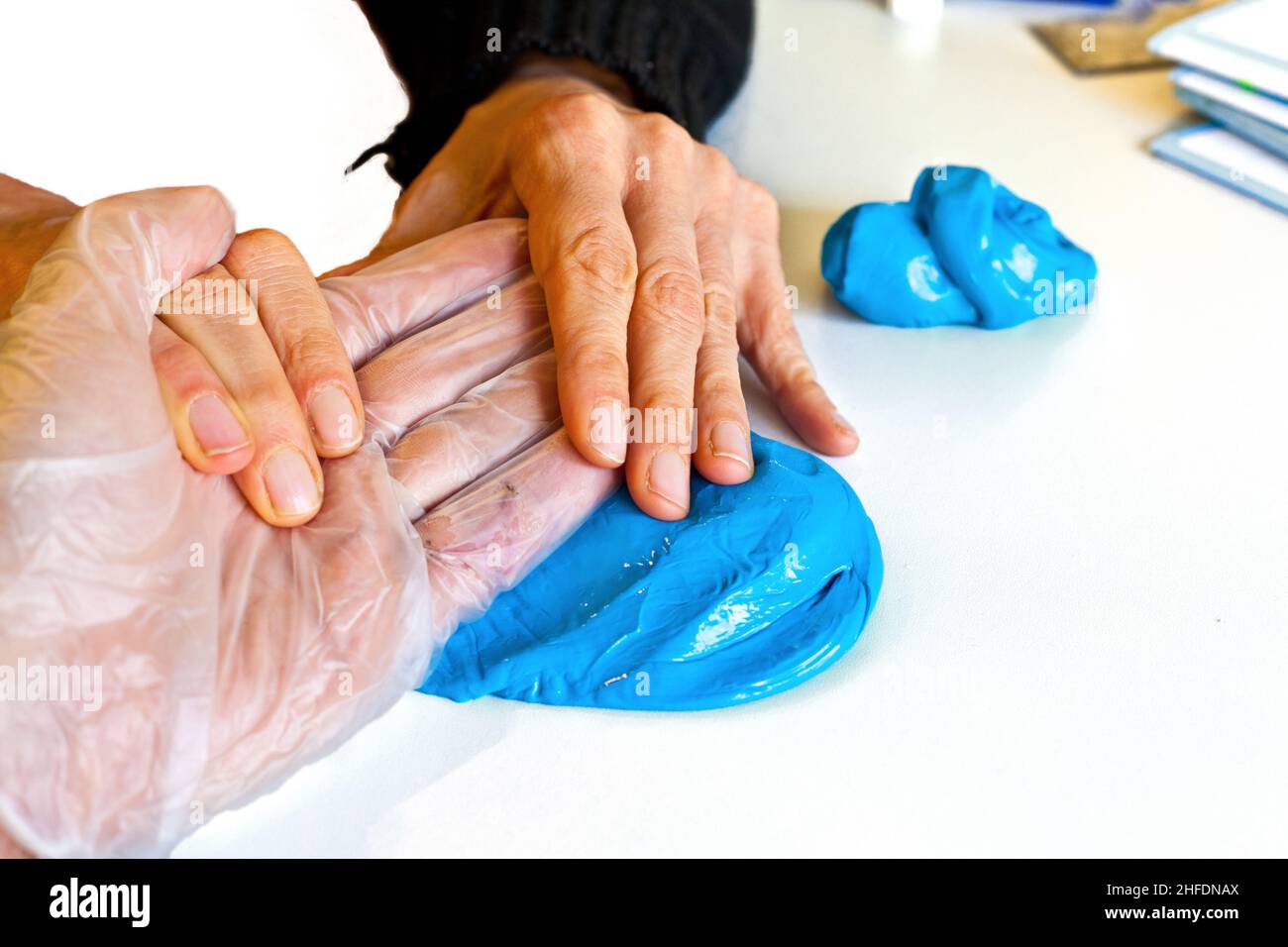 hand physiotherapy to recover a broken finder Stock Photo - Alamy