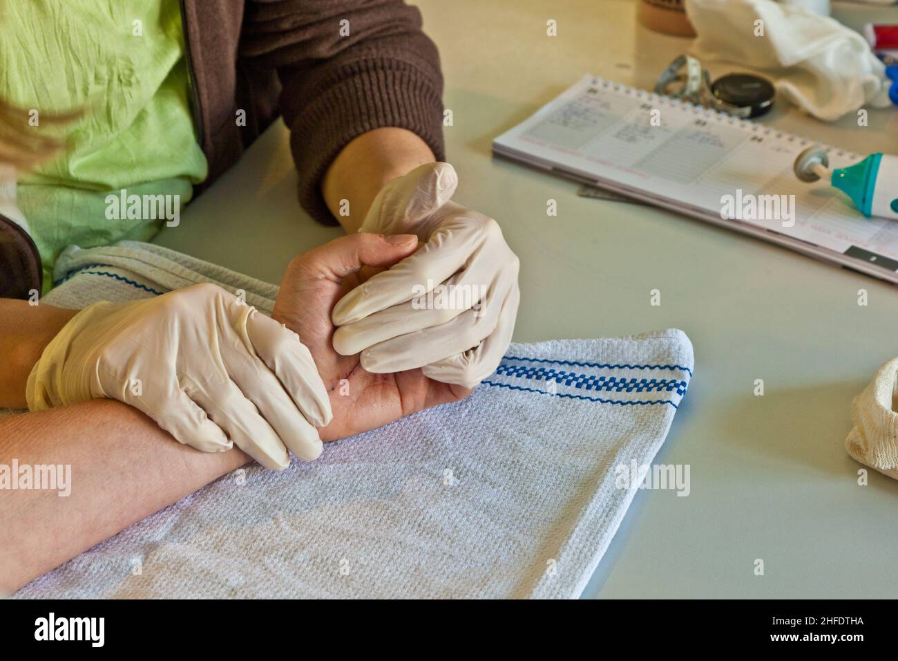 hand physiotherapy to recover a broken finger Stock Photo - Alamy