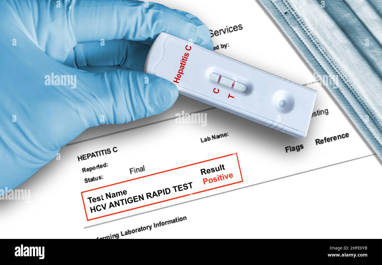 Hepatitis c testing kit hi-res stock photography and images - Alamy