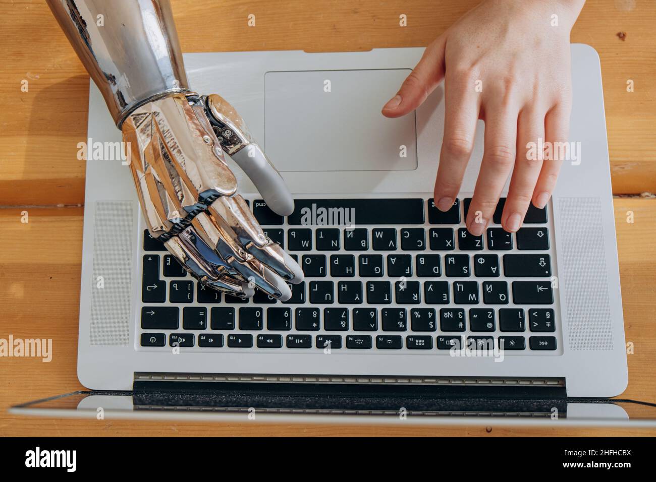 Young woman uses modern metal bionic arm to type on laptop keyboard ...