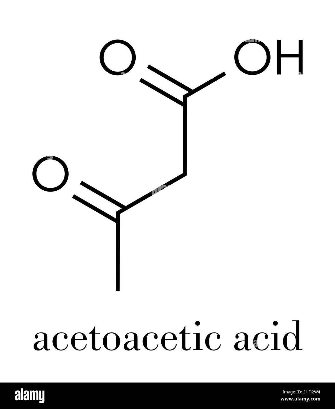 Ketone body (acetoacetic acid, diacetic acid) molecule. Skeletal ...