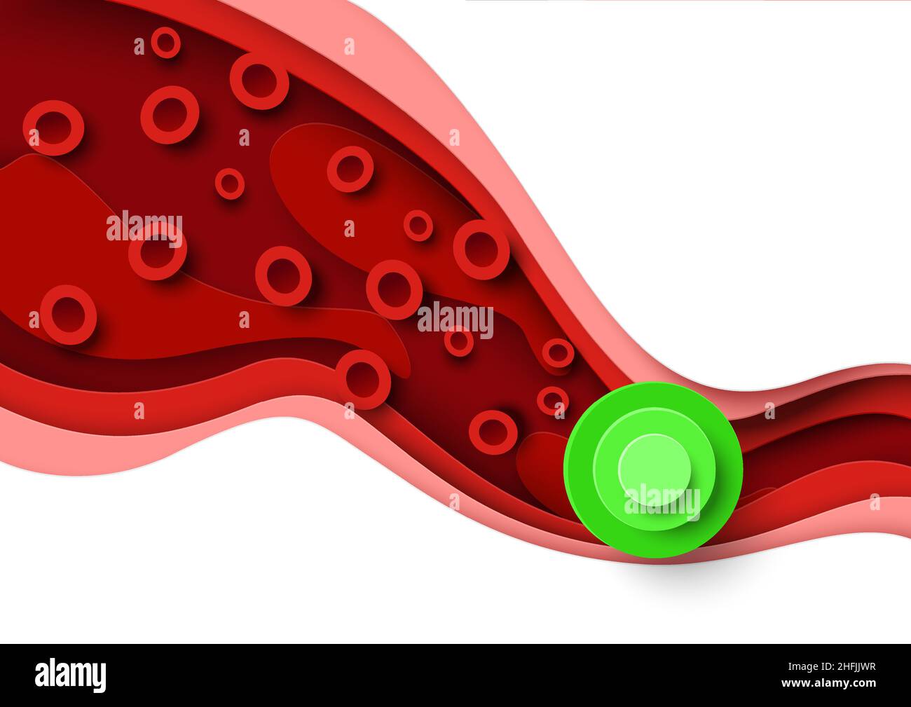 Cholesterol in blood, vector paper cut illustration. High cholesterol ...