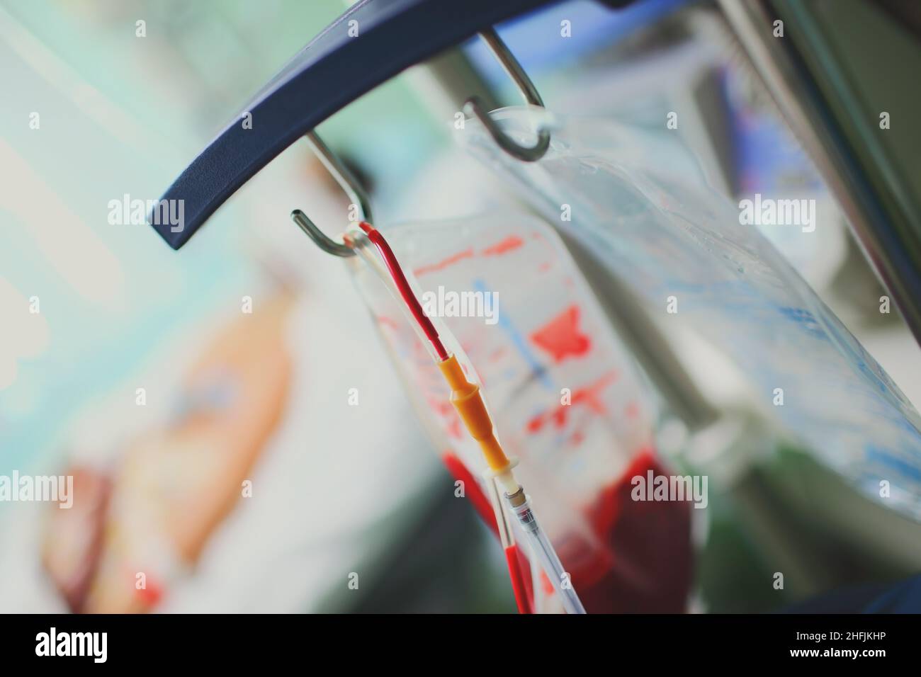 Blood transfusion bag hi-res stock photography and images - Alamy