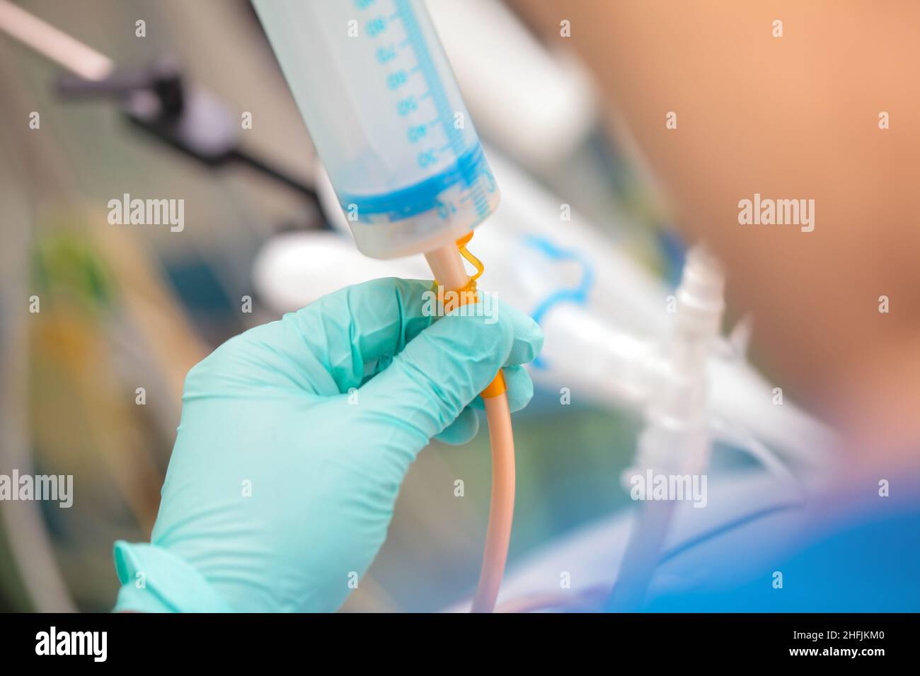 Nasojejunal hi-res stock photography and images - Alamy