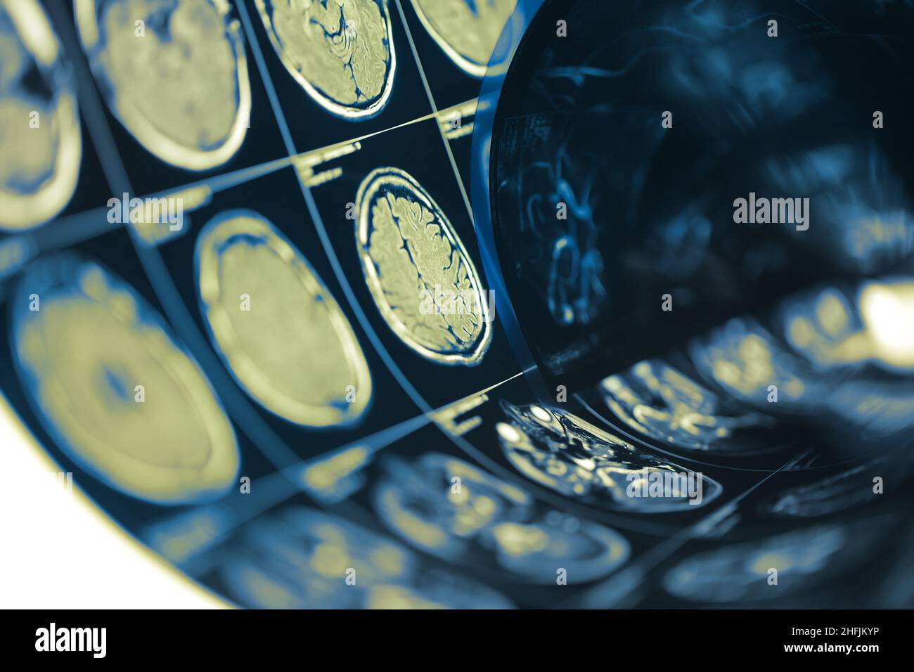 Human brain scan hi-res stock photography and images - Alamy