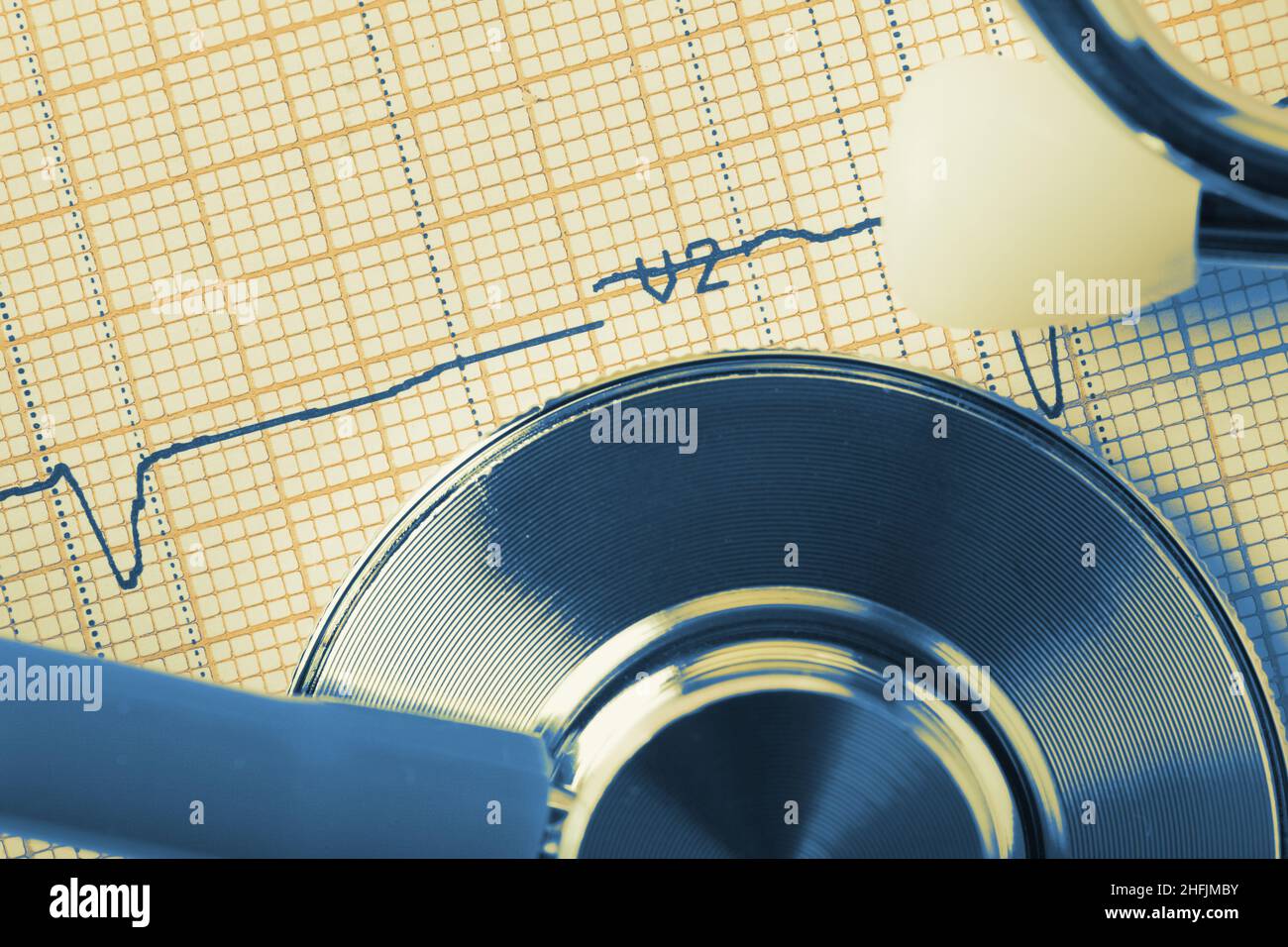 Stethoscope with ecg chart hi-res stock photography and images - Alamy