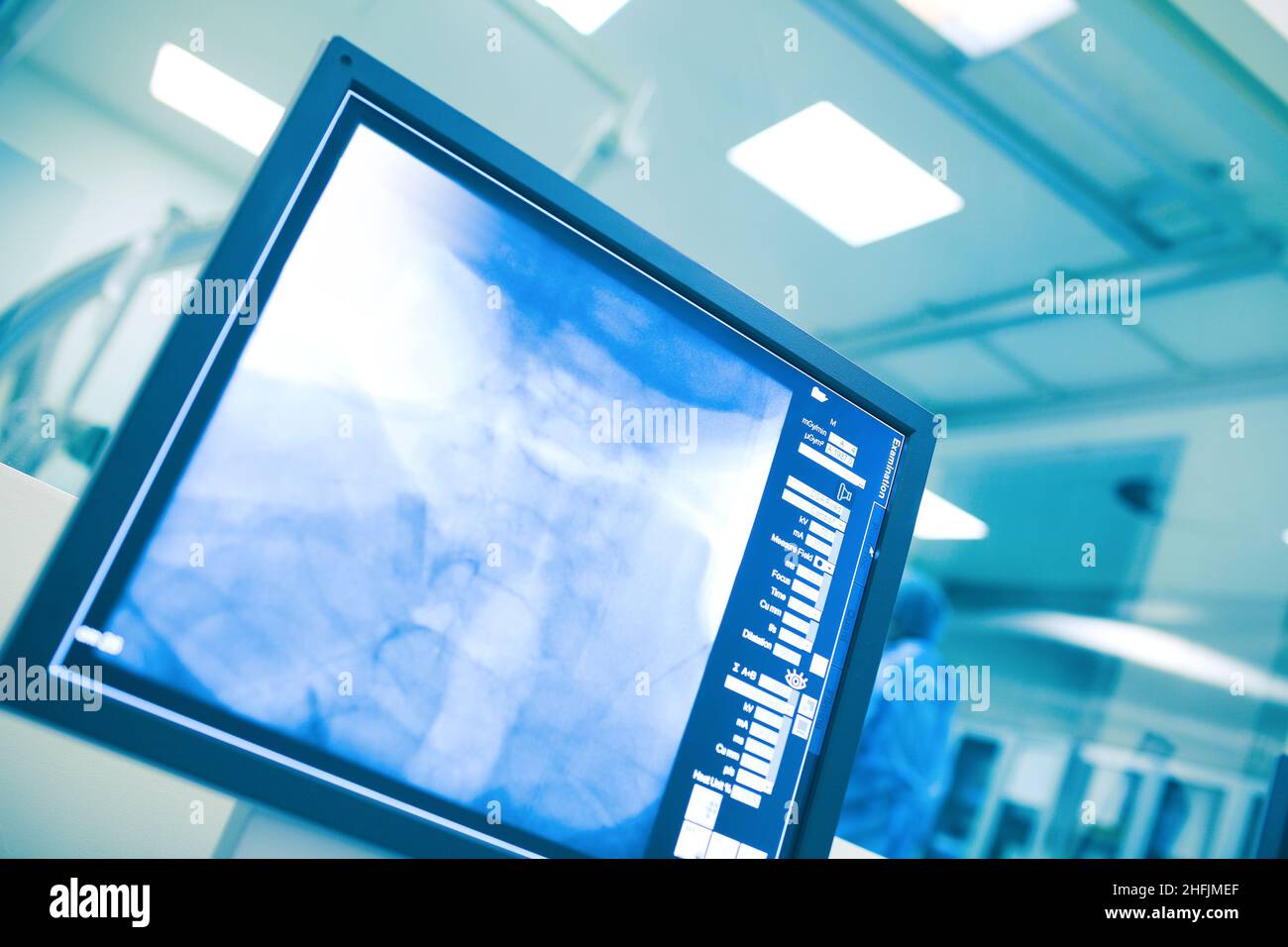 X-ray image on the monitor during patient examination, medical ...