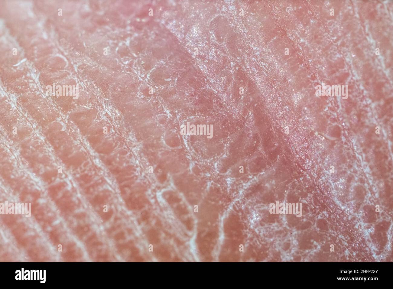 An extreme closeup of the skin on a fingertip. Dry and irritated skin ...