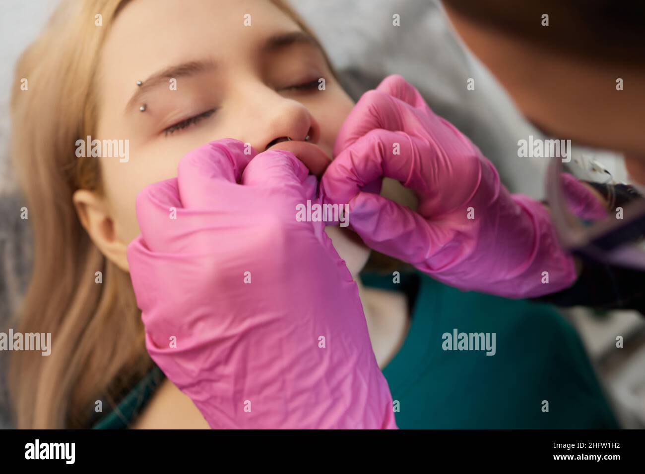 smile or frenulum piercing under the upper lip Stock Photo - Alamy