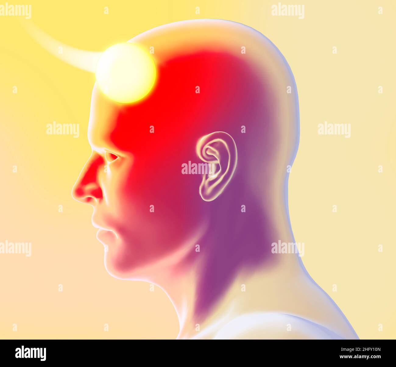 Face of a man seen from the side, headache and sinusitis. Pill to ...