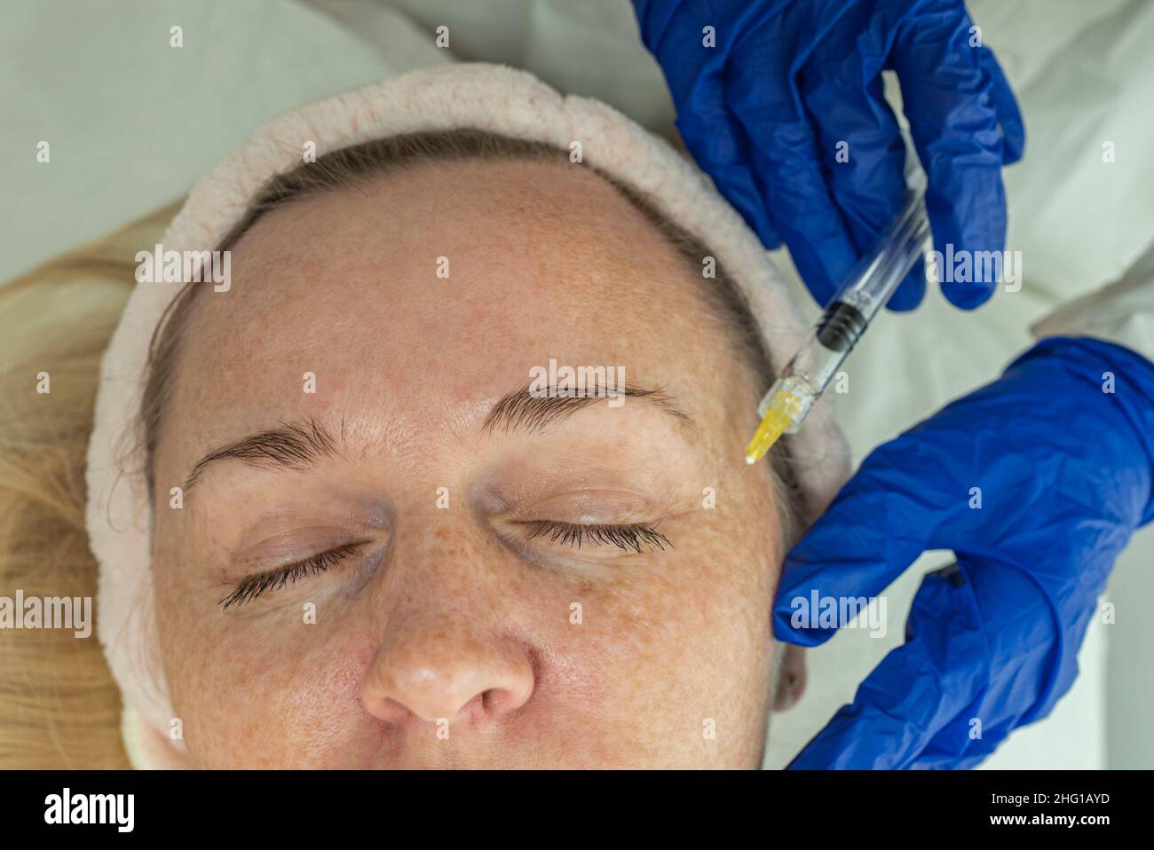 Treatment of the face. Injection of beauty near the eyes. Women's skin ...