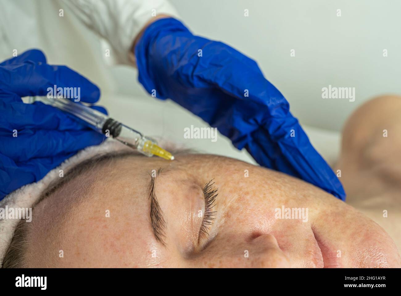 Face injection hi-res stock photography and images - Alamy