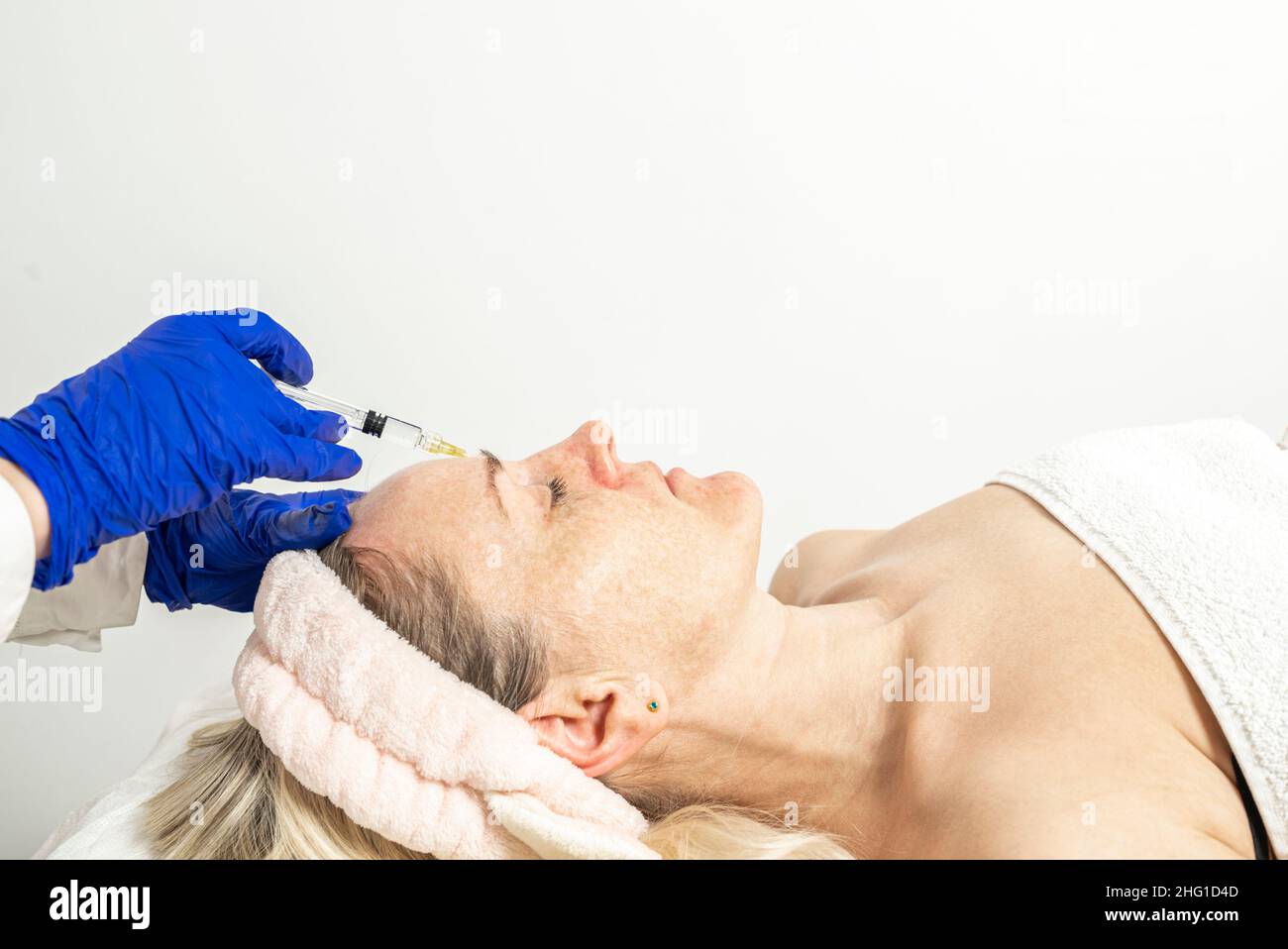 botulinum toxin injection on eye area, for lifting skin around eyes ...