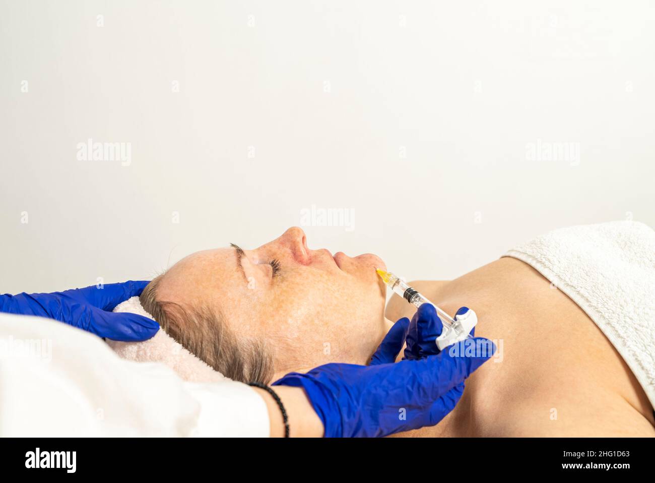 botulinum toxin injection on eye area, for lifting skin around eyes ...