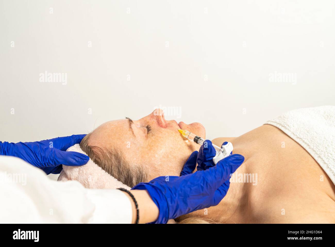 botulinum toxin injection on eye area, for lifting skin around eyes ...