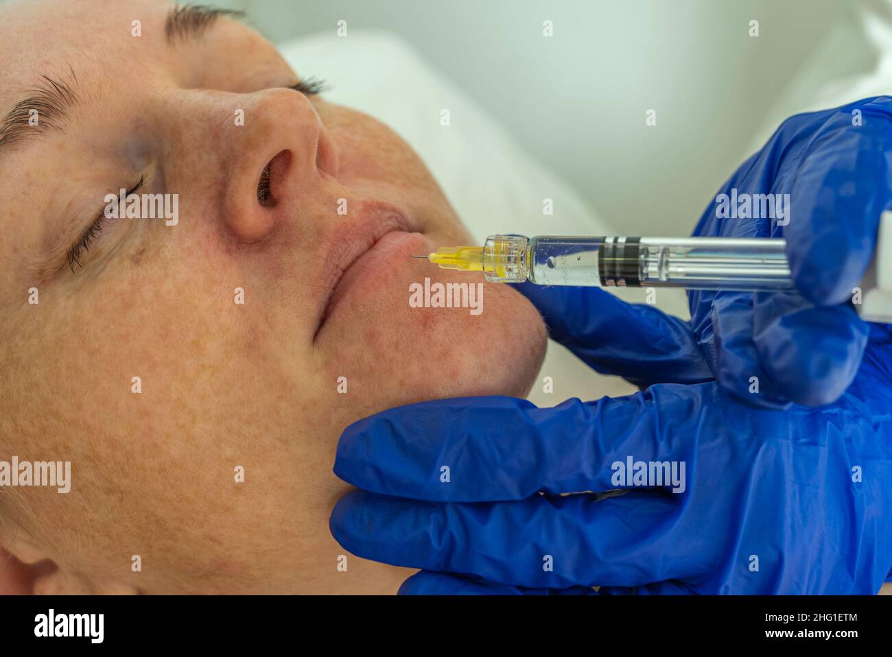 Beauty injection. Women's skin care procedure in a cosmetic clinic ...