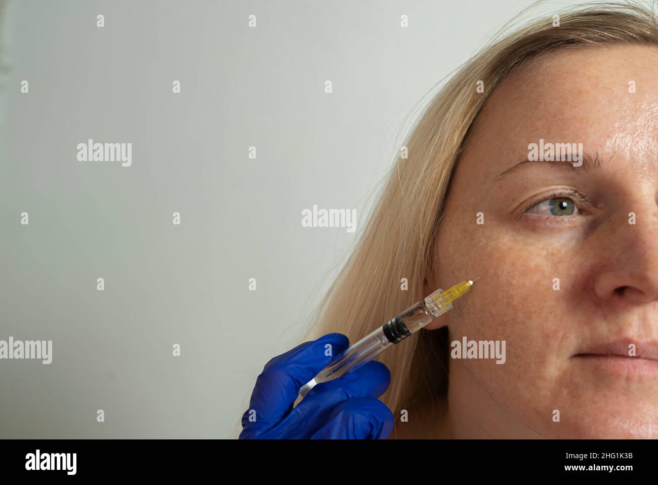 a young woman makes cosmetic skin injections, facial mesotherapy with ...