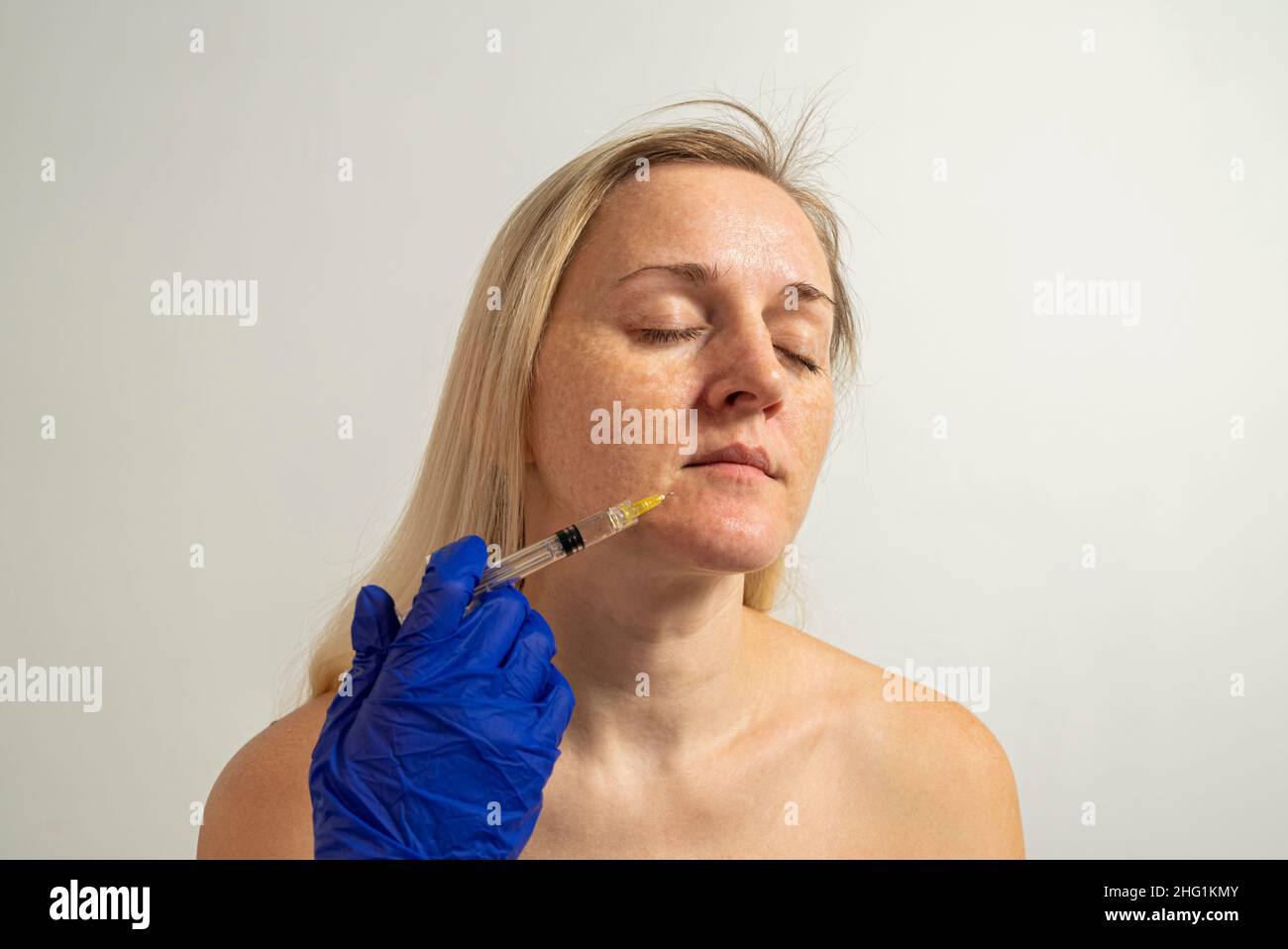 a young woman makes cosmetic skin injections, facial mesotherapy with ...