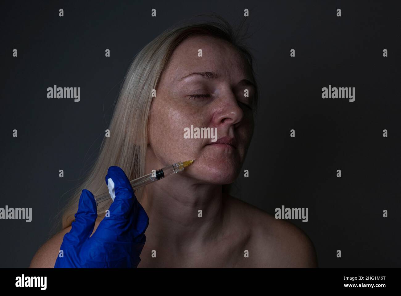 a young woman makes cosmetic skin injections, facial mesotherapy with ...