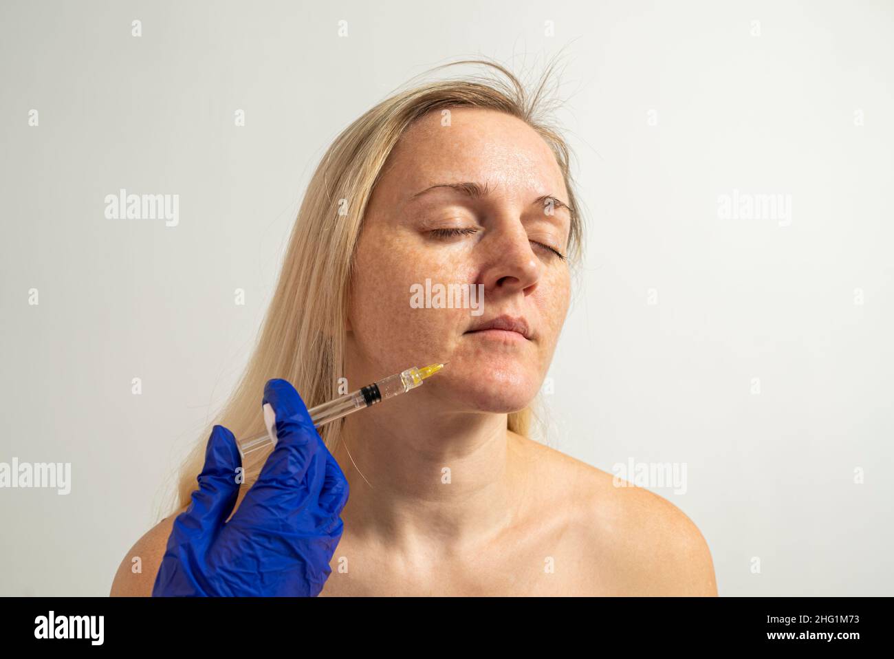 a young woman makes cosmetic skin injections, facial mesotherapy with ...