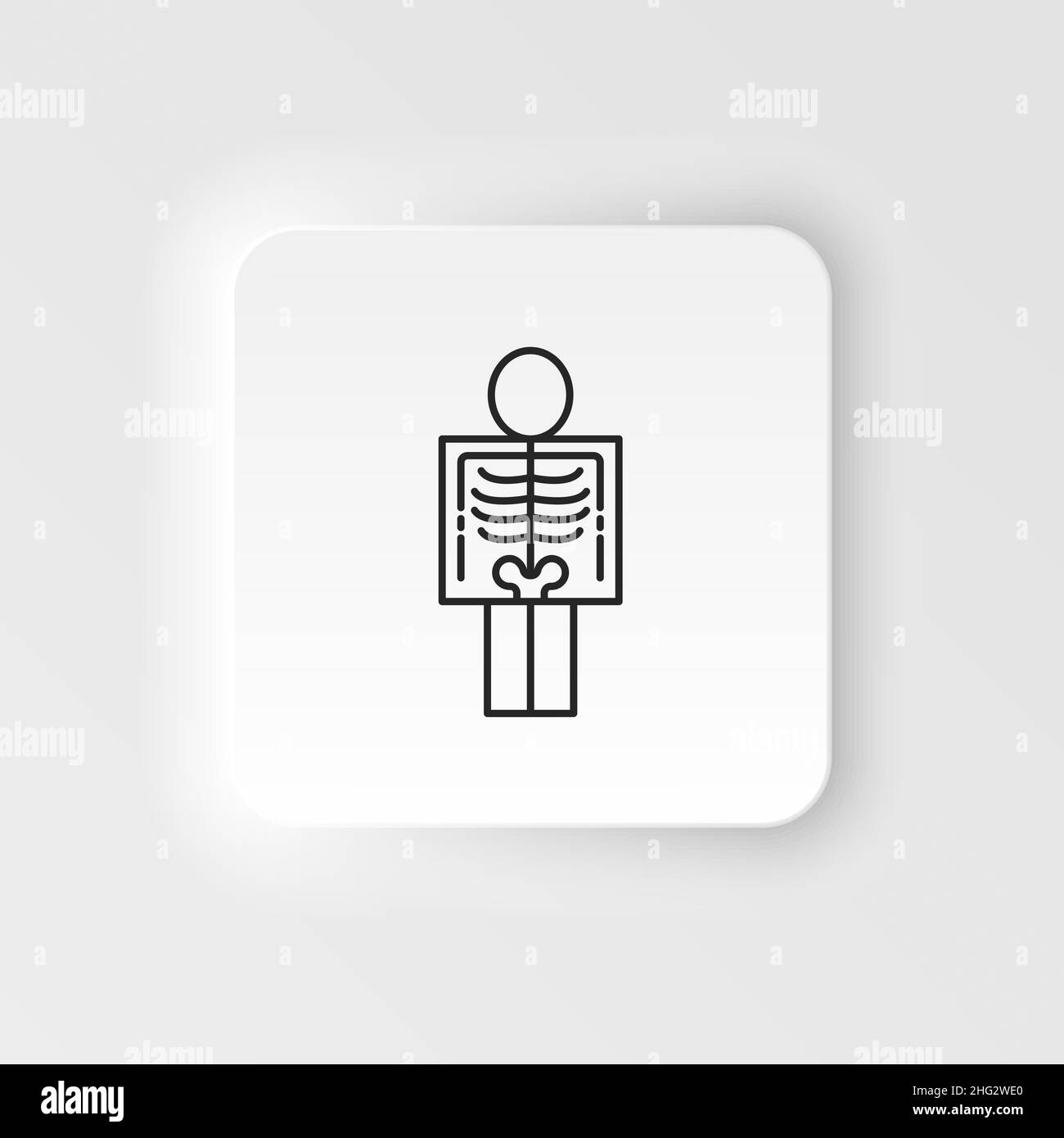 Diseases, patient, roentgen vector. Muscle aches, cold and bronchitis ...