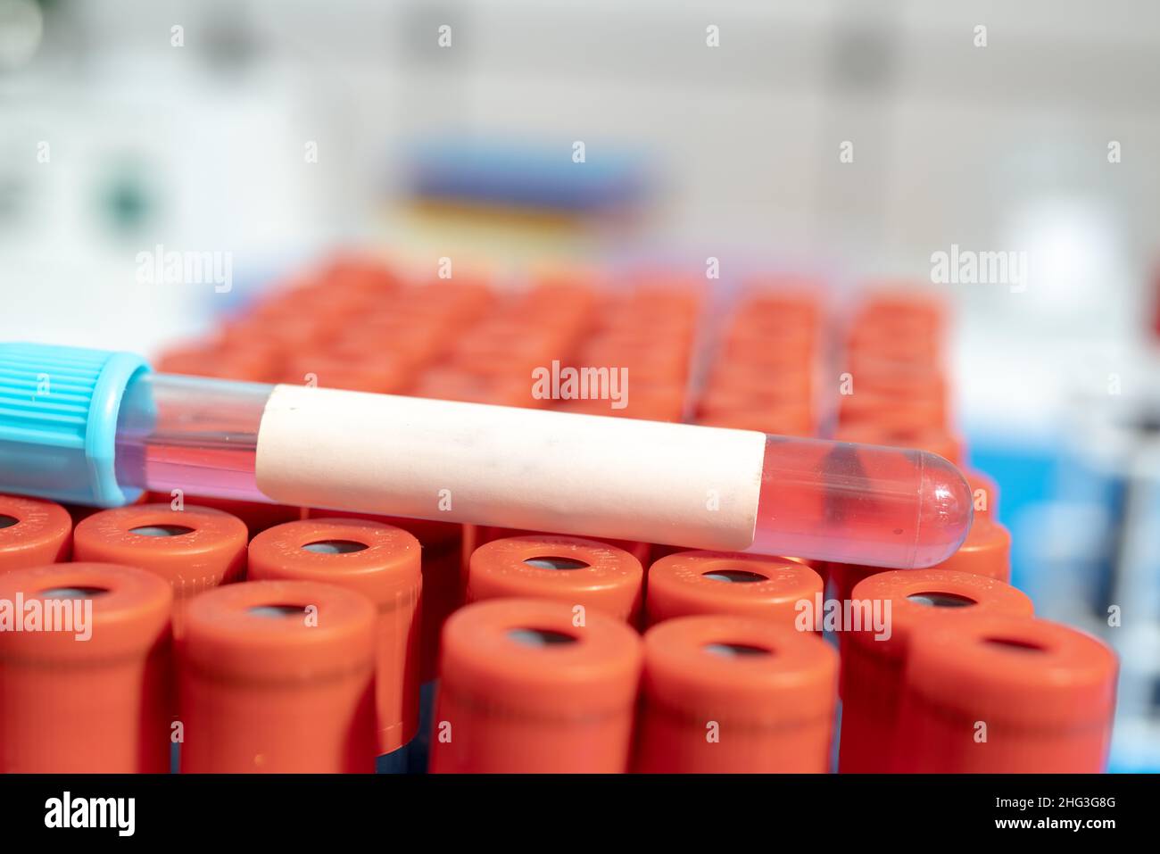Test tube with empty label to biological sample for medical laboratory ...