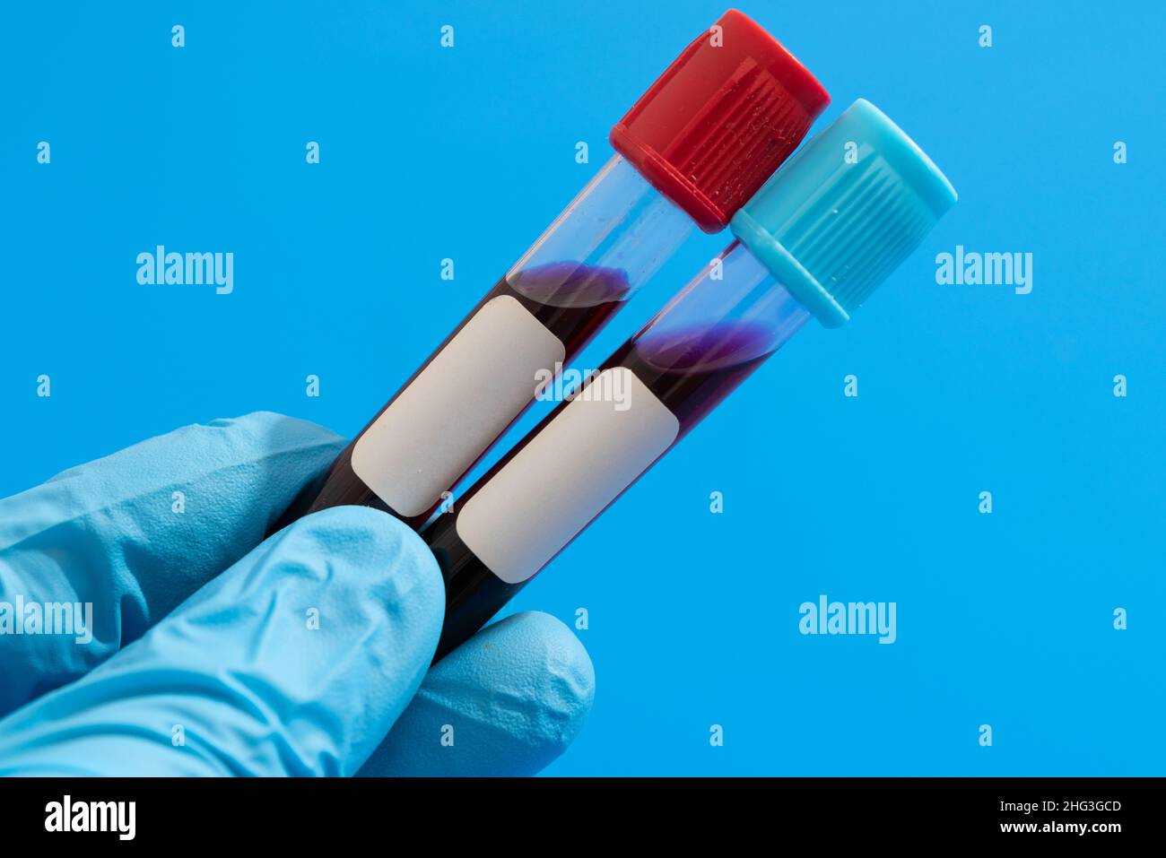 Two Test tube with empty label to biological sample for medical ...