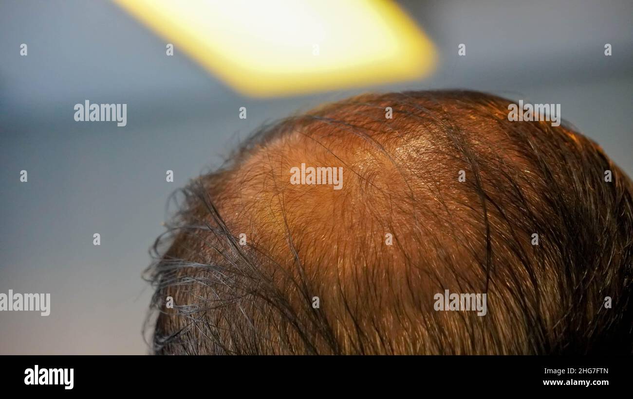 Behind old bald man hi-res stock photography and images - Alamy
