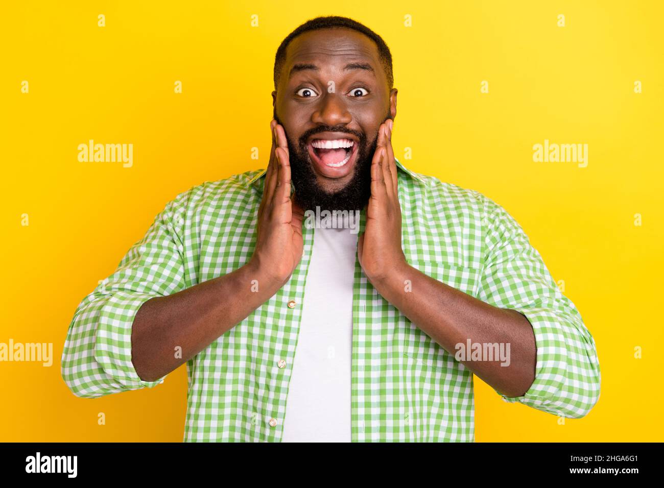 Portrait of astonished cheerful person arms on cheeks open mouth ...