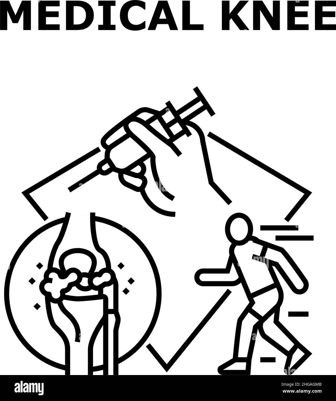 Image of the structure of the cartilage Stock Vector Images - Alamy