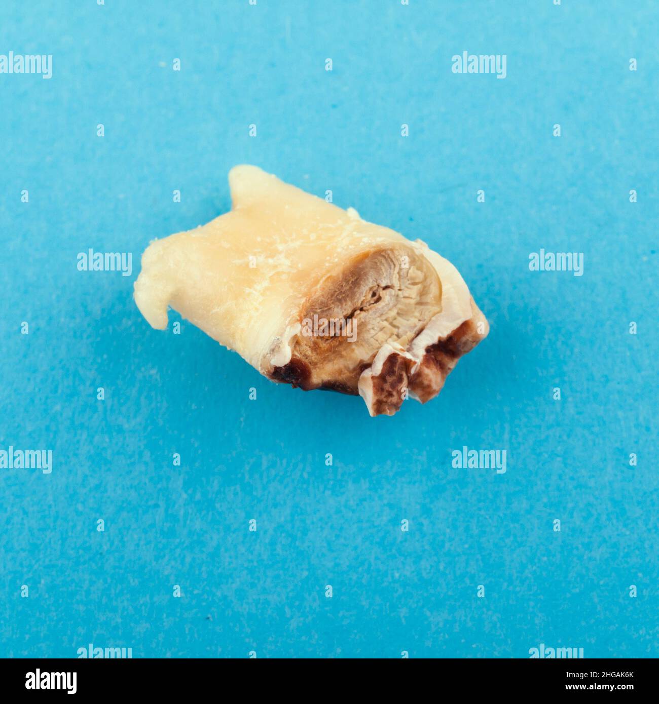 Single extracted third molar with caries decay Stock Photo - Alamy