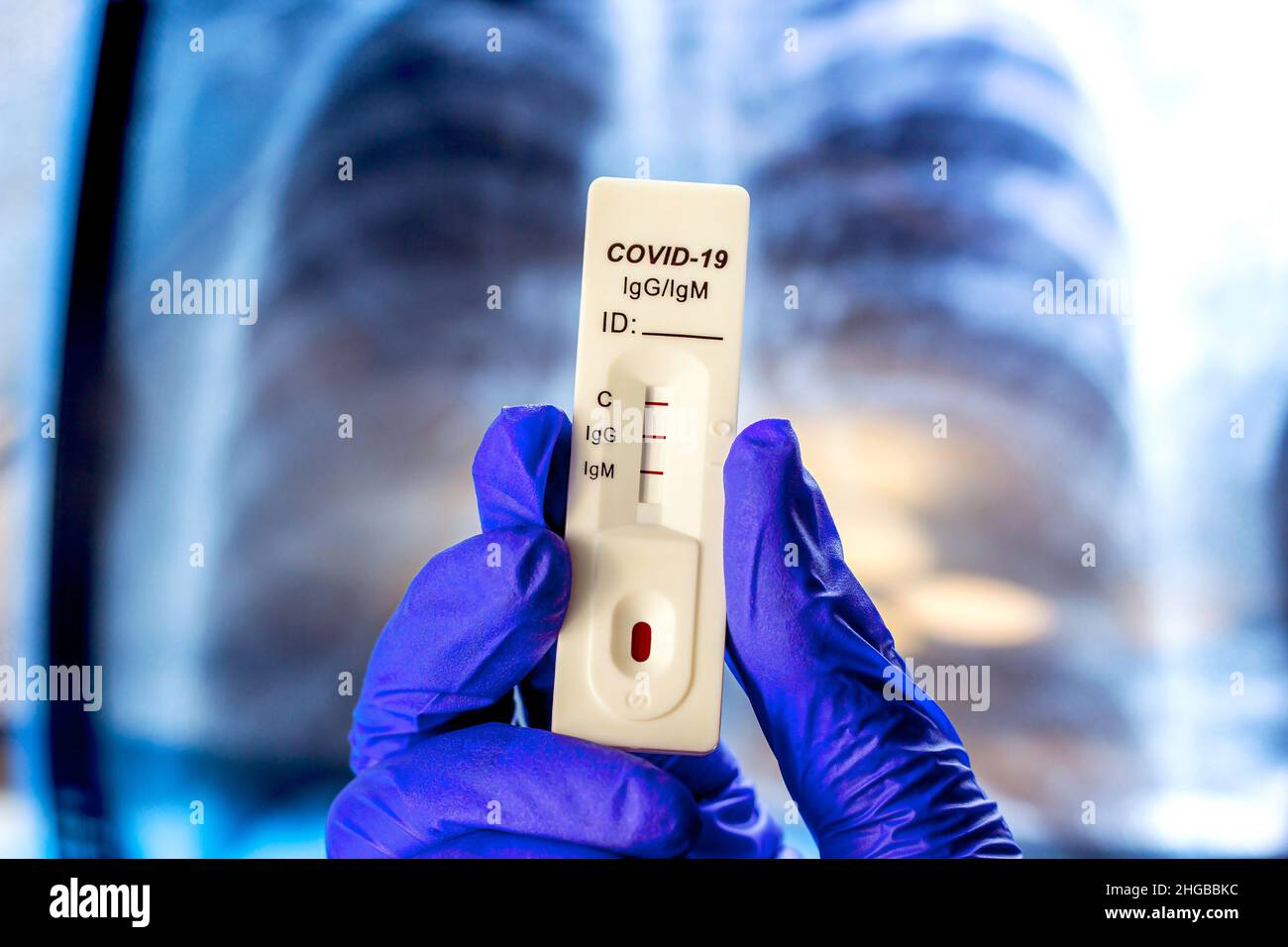 Medical covid-19 antibody and antigen positive rapid self test in ...