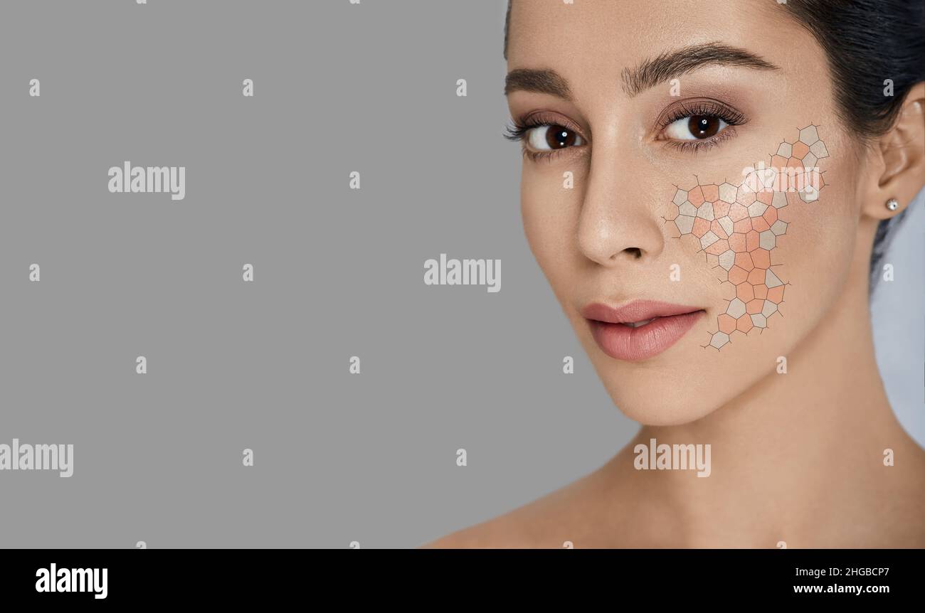 Female face with skin problems, concept. Dry and irritated skin on ...