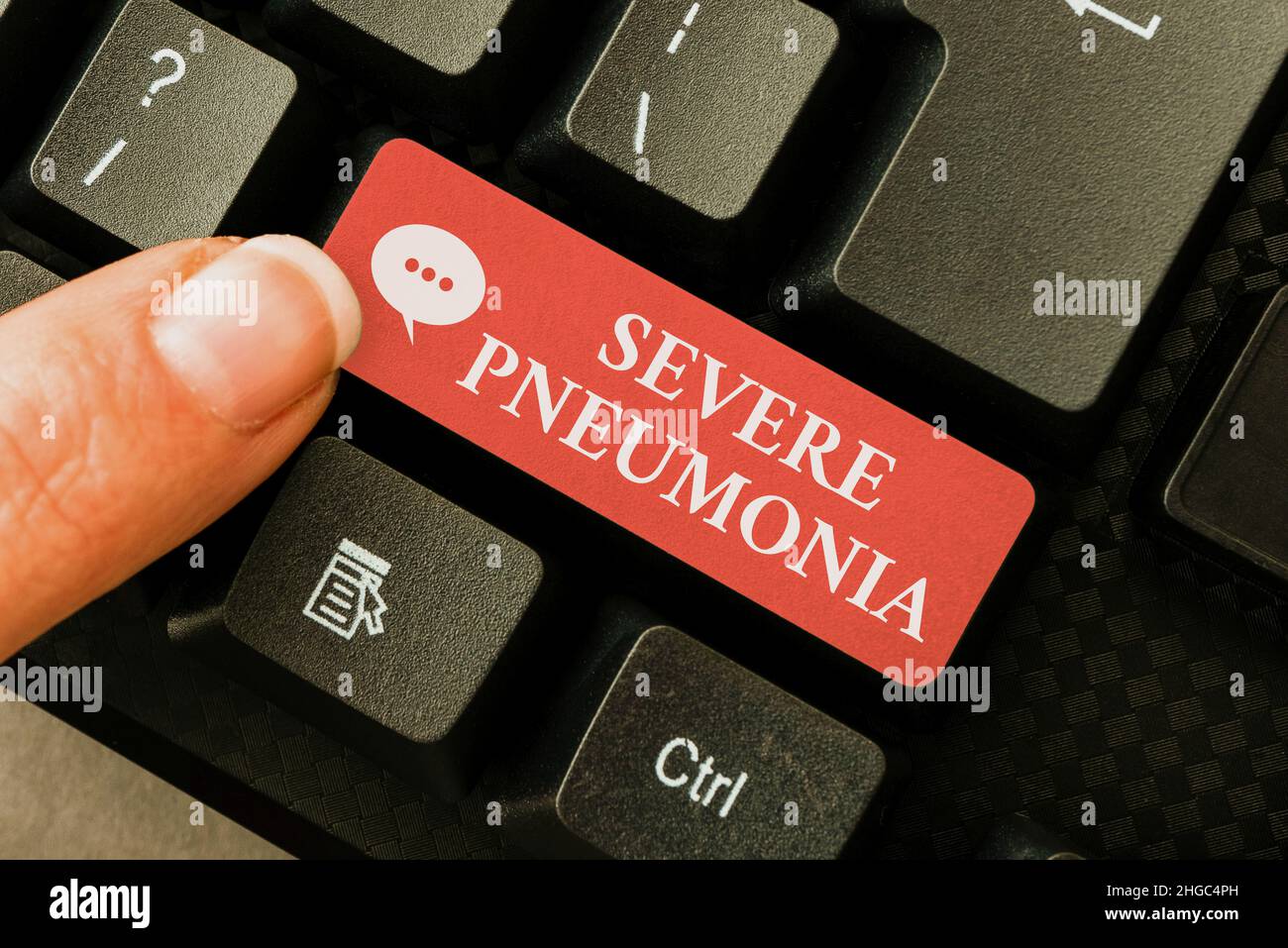 Handwriting text Severe Pneumonia. Concept meaning acute disease that ...