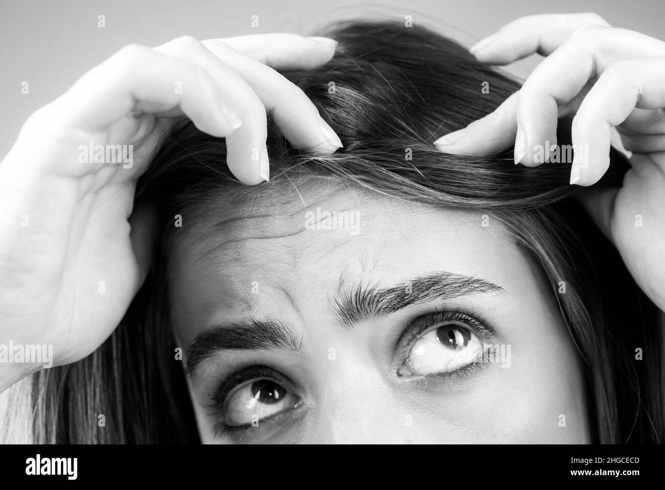 Woman with hair loss problem. Portrait of Young girl with a bald. Head ...