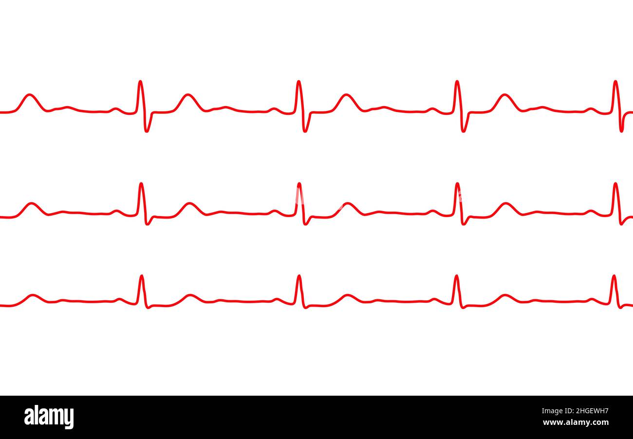 Heart beat ecg or ekg seamless red line on white. Electrocardiogram ...