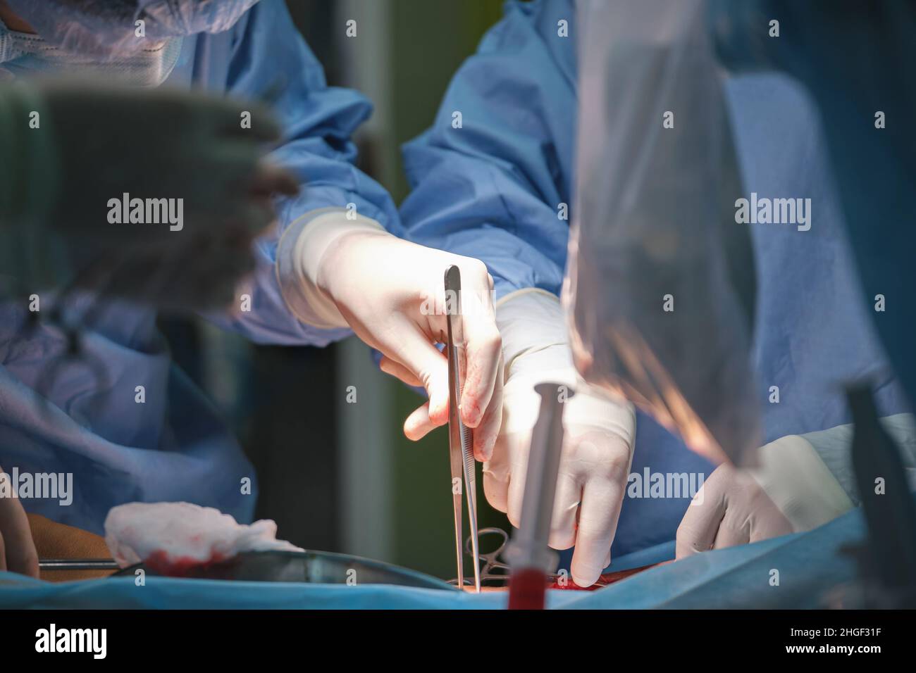 Closeup of doctors hands operating a patient conducting open cut ...