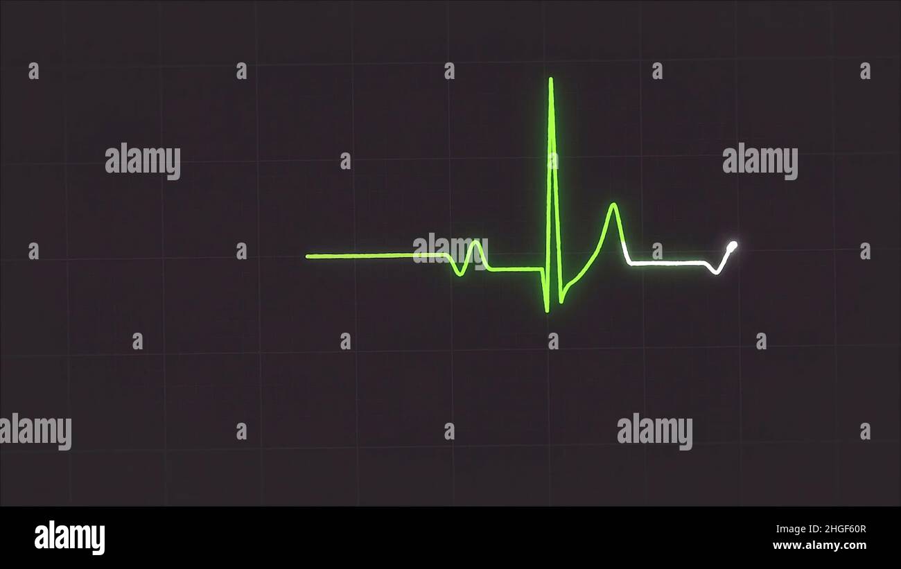 Av23213c hi-res stock photography and images - Alamy